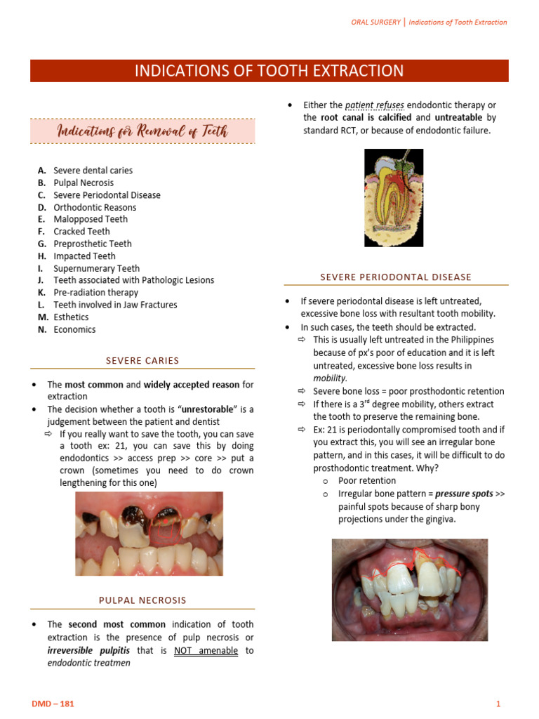 5-Indications of Tooth Extraction | PDF