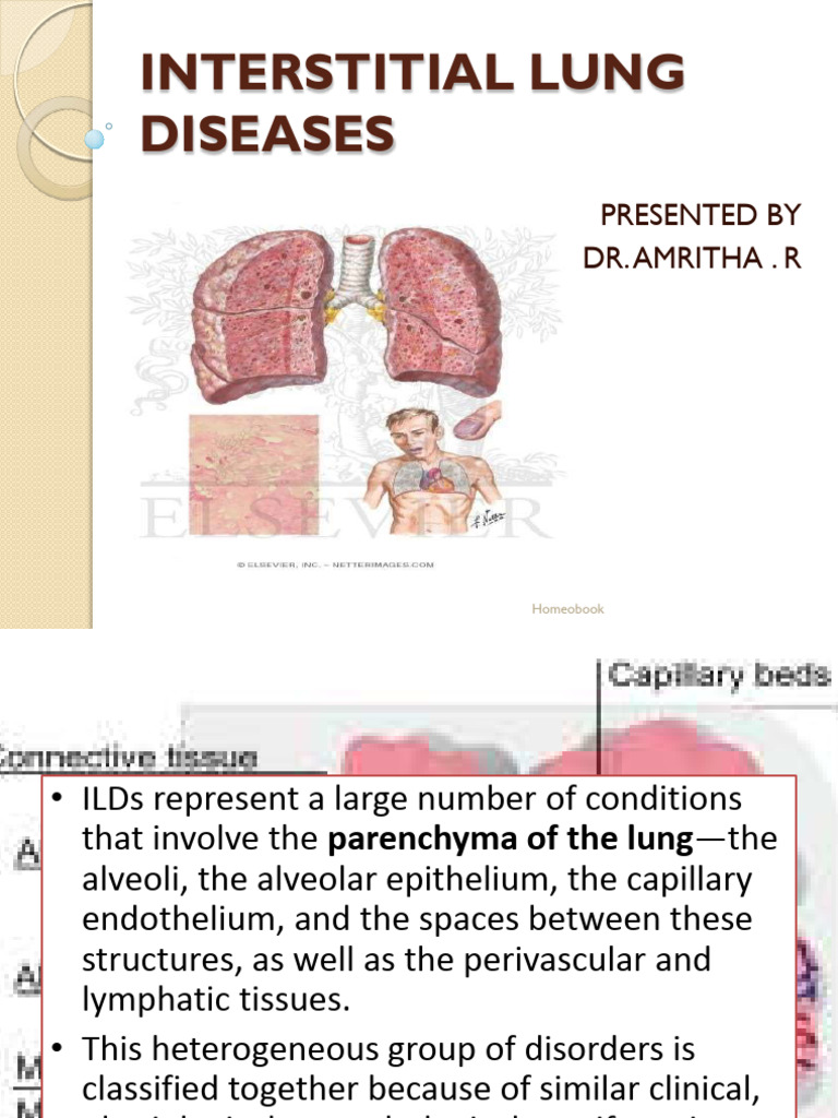 A Case of Interstitial Lung Diseases | PDF