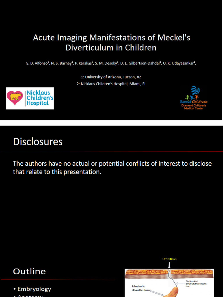 Acute Imaging Manifestation of Meckel Diverticulum in Children | PDF