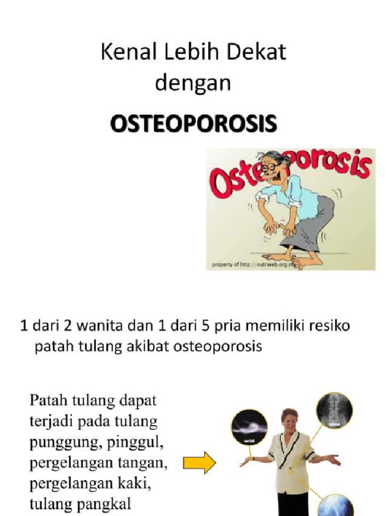 Osteoporosis Pdf