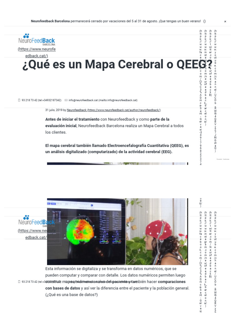 ¿Qué Es Un Mapa Cerebral o QEEG - NeuroFeedBack Barcelona | PDF