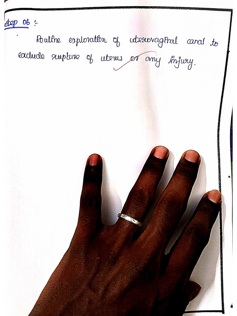 Destructive Operations | PDF