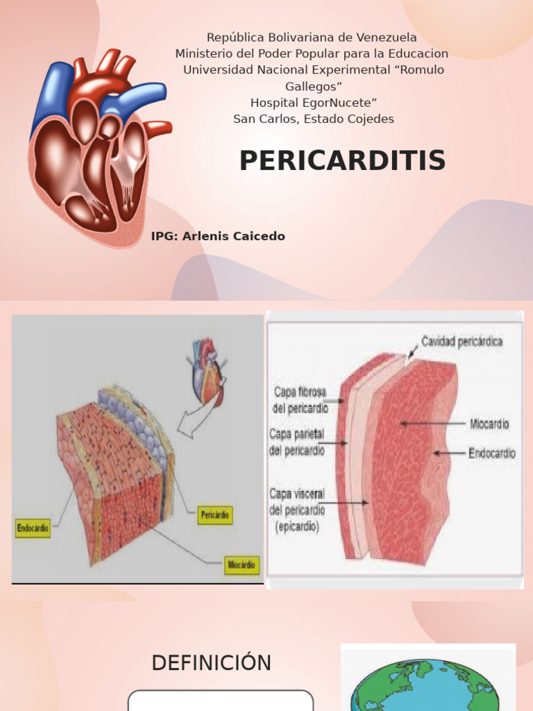 Pericarditis | PDF