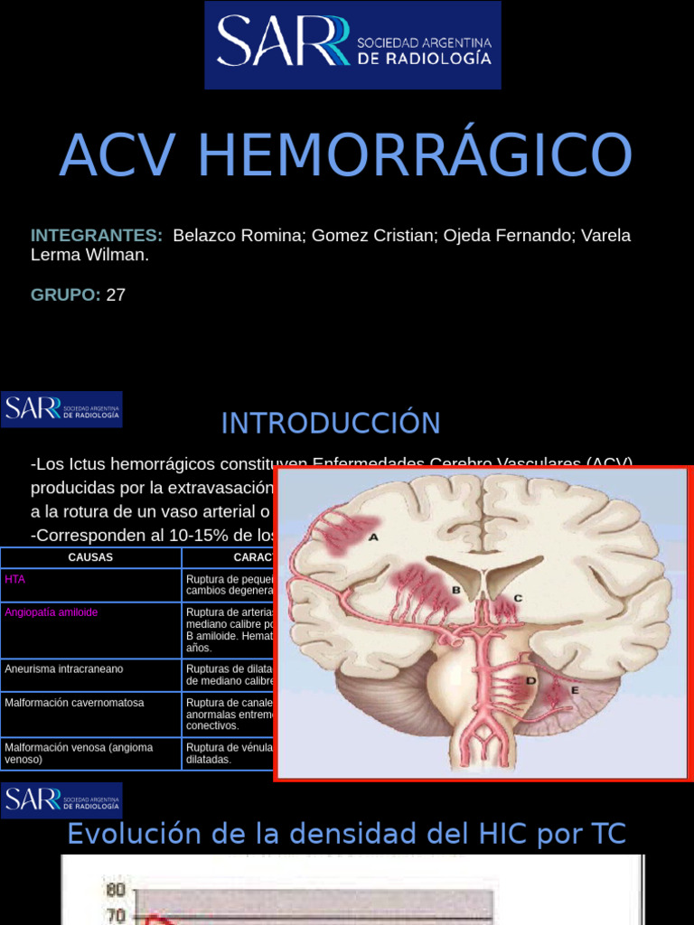 Acv Hemorragico - Sar 2024 Corregido | PDF