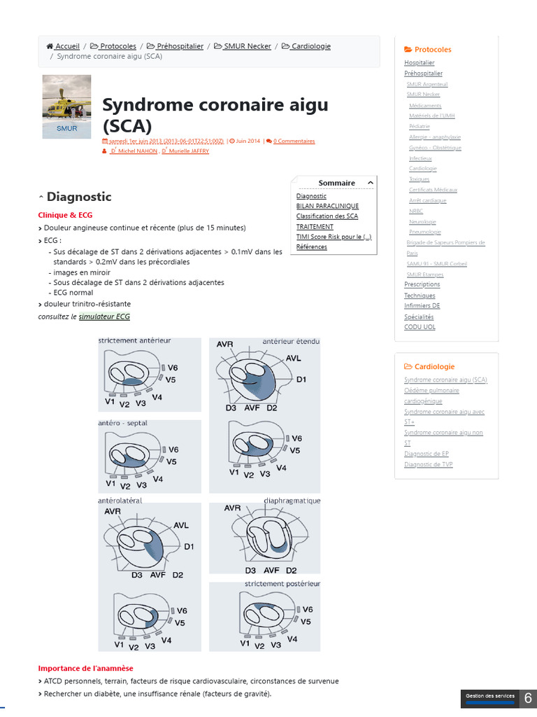 Syndrome Coronaire Aigu (SCA) | PDF