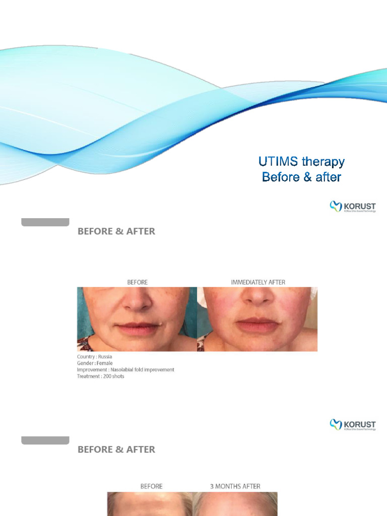 BEFORE AND AFTER KORUST UTIMS | PDF