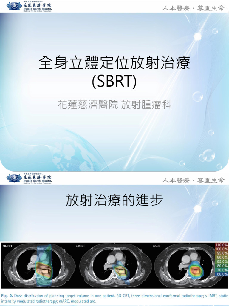 SBRT - general | PDF