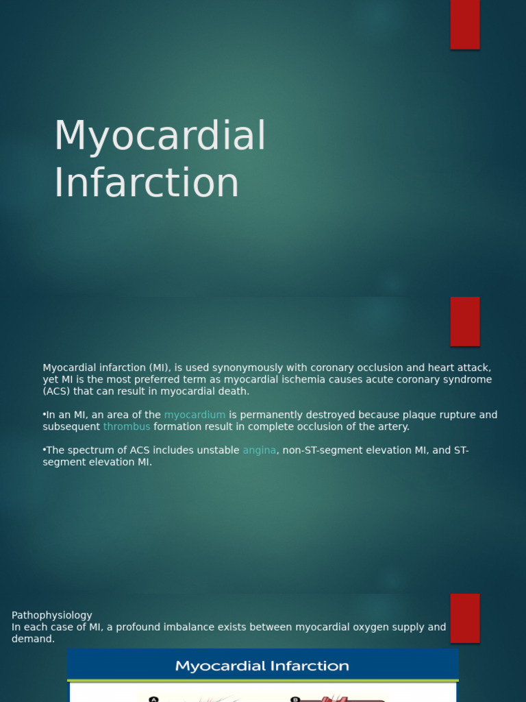 Myocardial Infarction | PDF