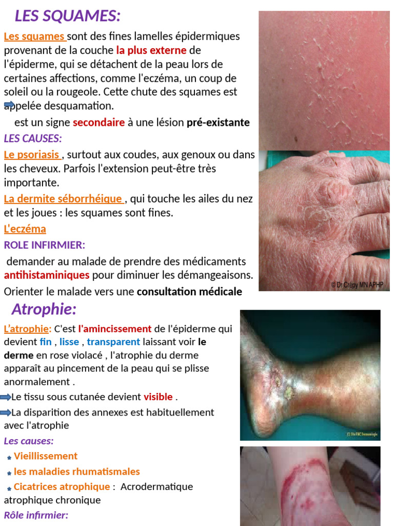 Les Squames | PDF