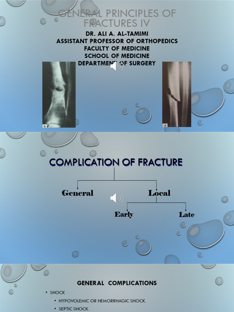 General Principles of Fracture IV General Complications P1 | PDF