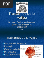 Persistencia de Uraco Resuelto Con Tratamiento Quirúrgico Reporte de ...