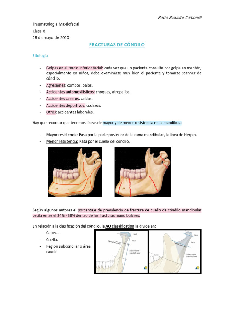 Fracturas de Condilo | PDF