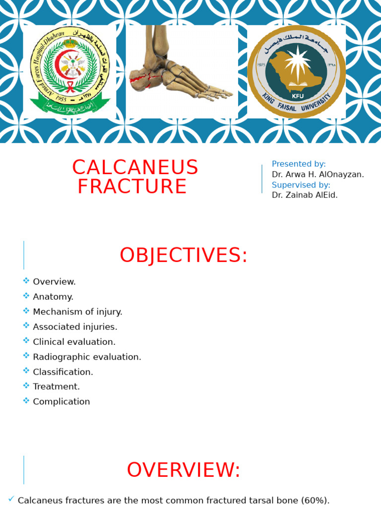 Calcaneus Fracture | PDF