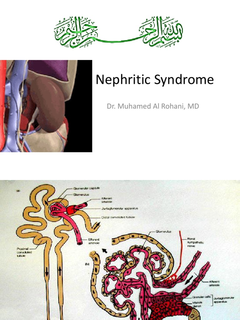 Nephritic Syndrome | Kidney Disease | Kidney