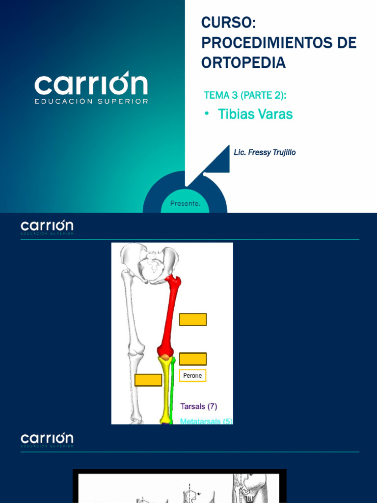 Clase 3 - Parte 2 - T-O 24 | PDF
