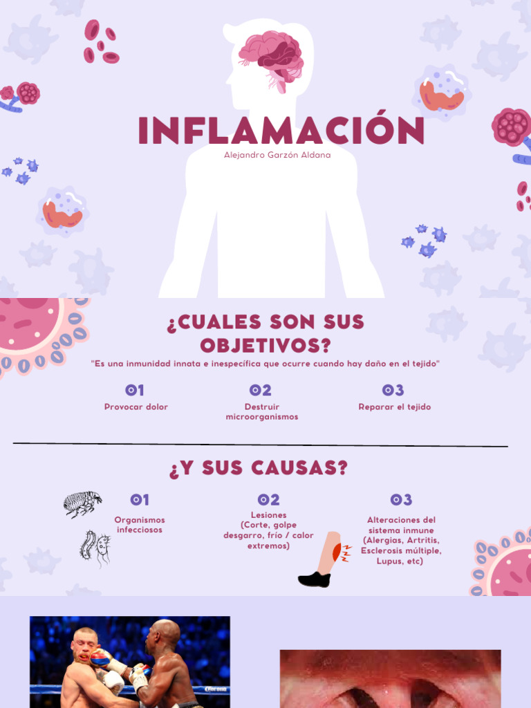 Respuesta Inflamatoria - Alejandro Garzón | PDF