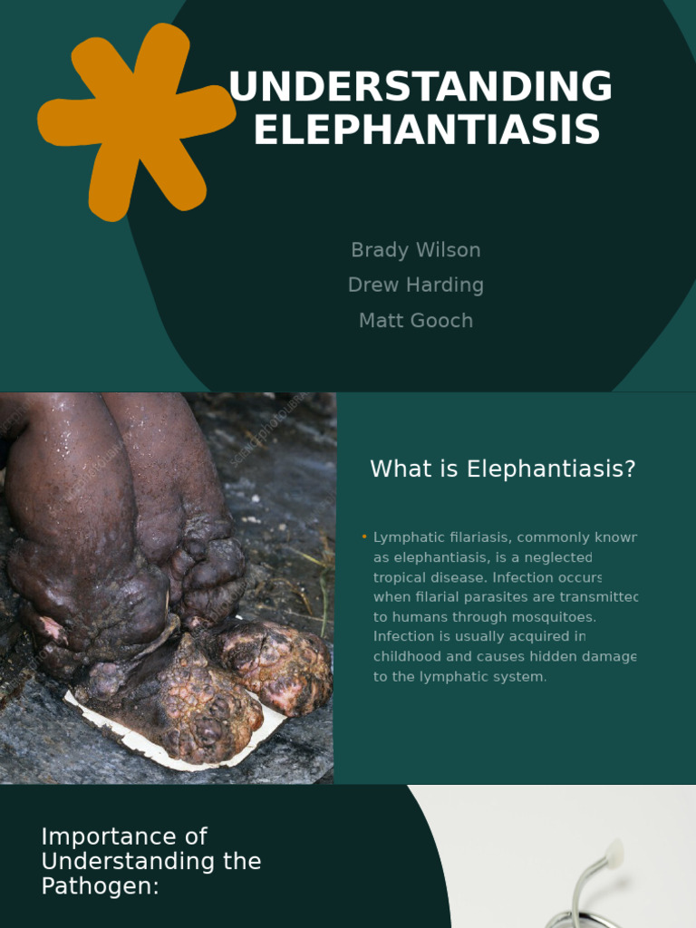 Elephantiasis | PDF