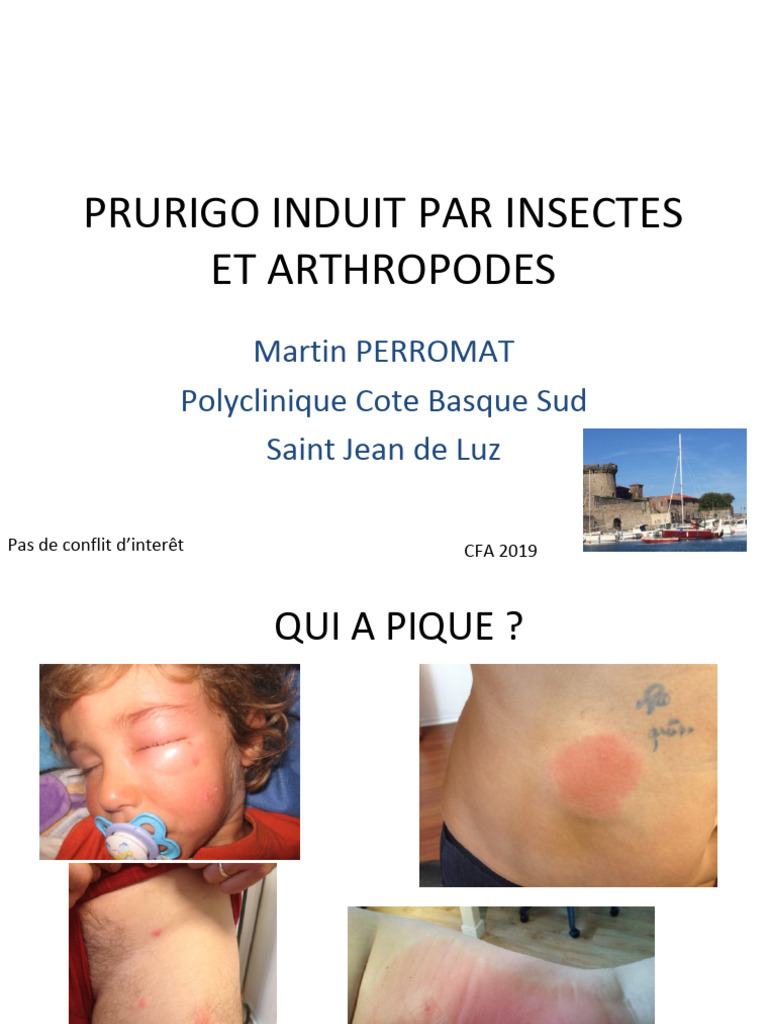 Prurigo Induit Par Insectes Et Arthropodes | PDF