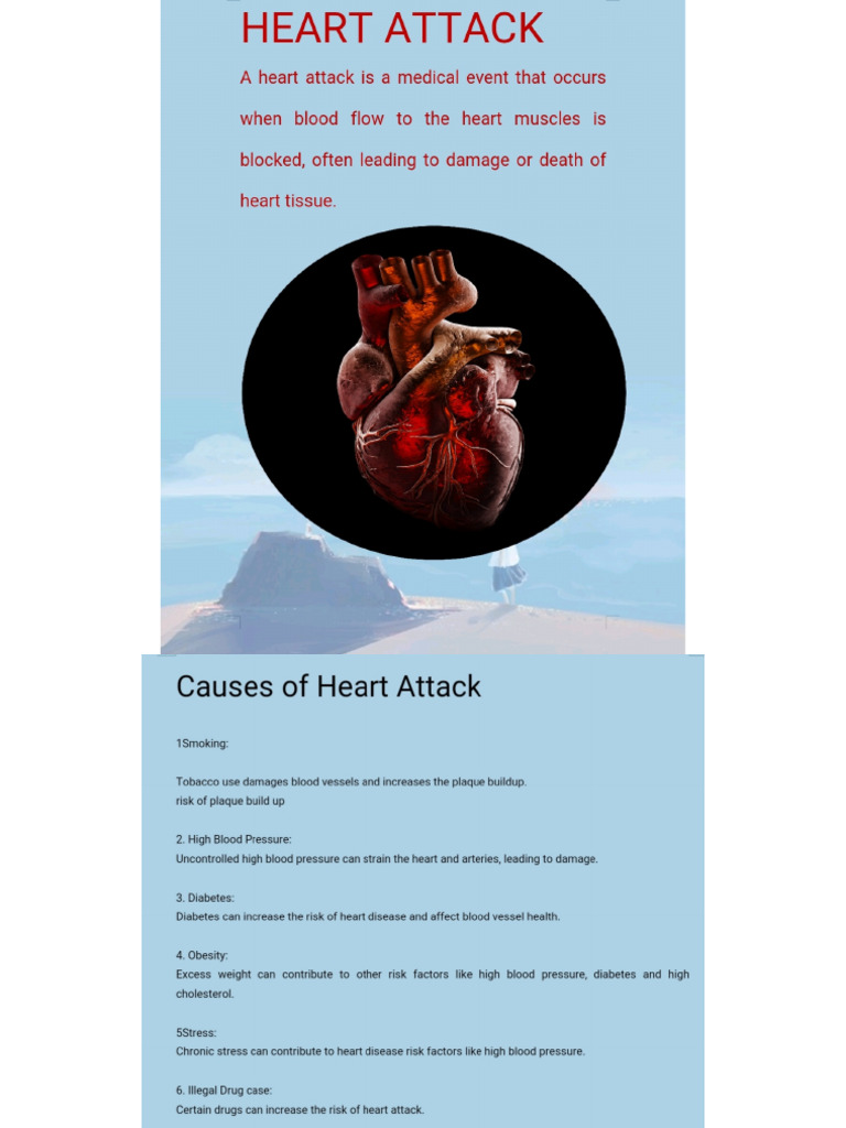 Heart Attack | PDF