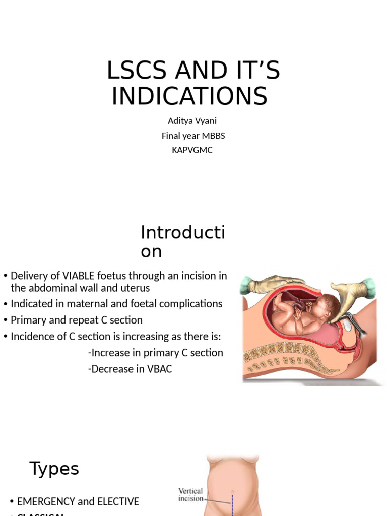LSCS and It's Indications | PDF