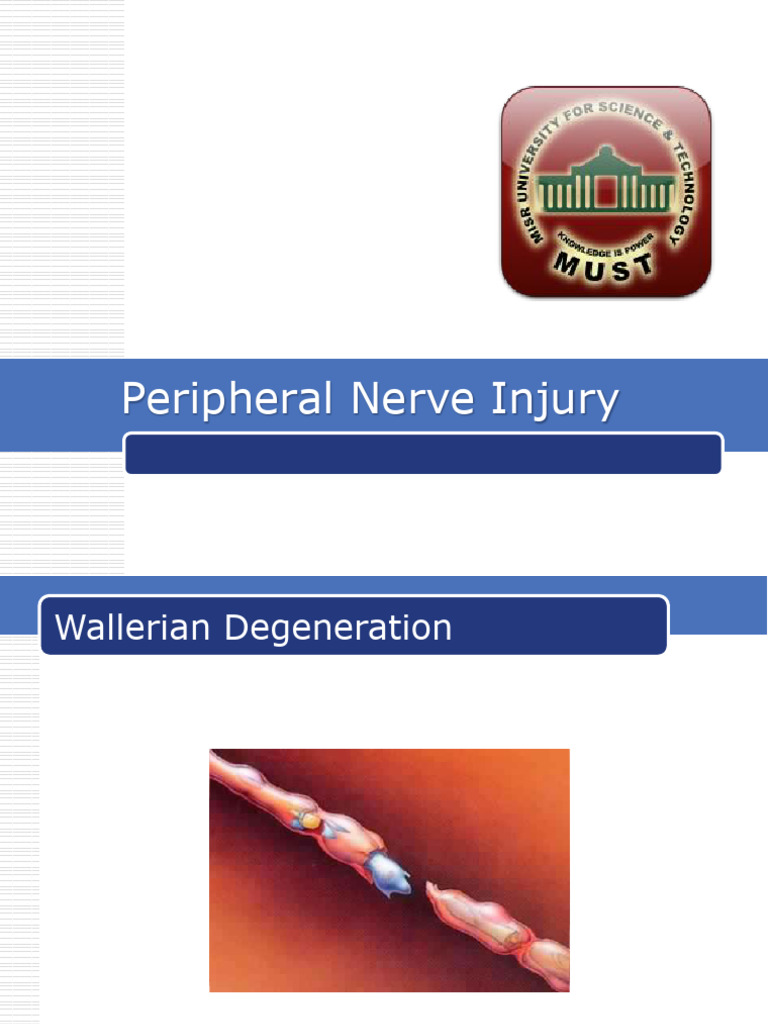 Peripheral Nerve Injury | PDF