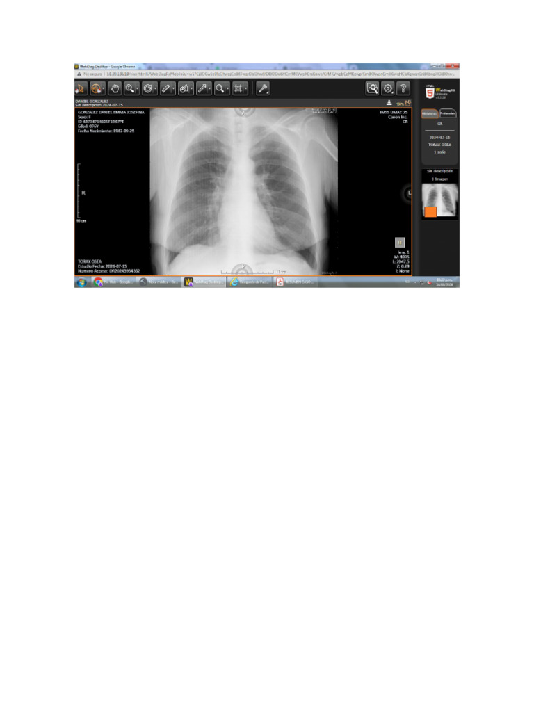 RX | PDF