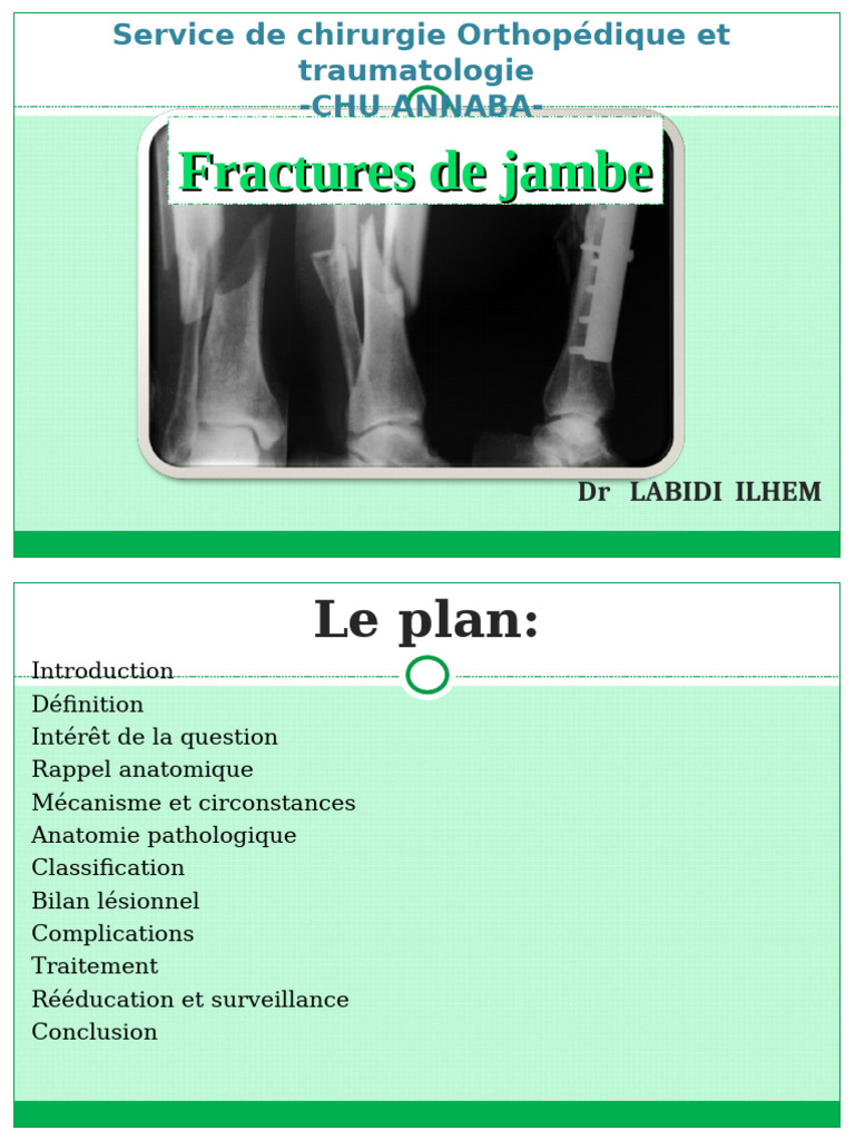 15 Fracture de La Jambe | PDF
