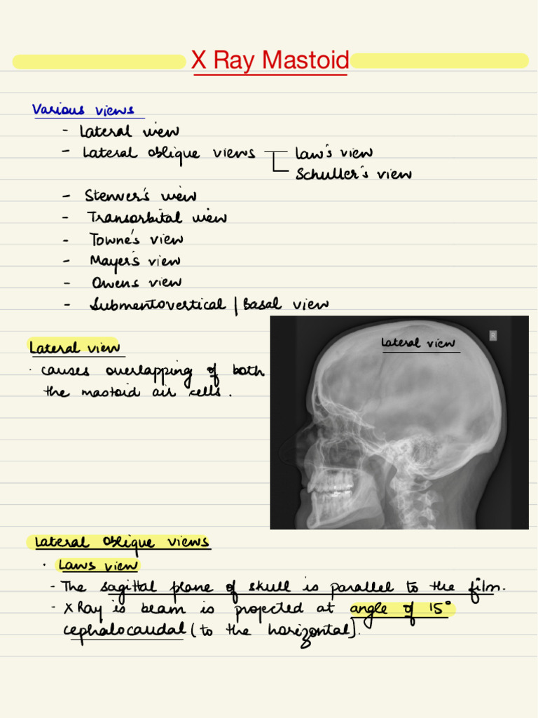 X Ray Mastoid | PDF