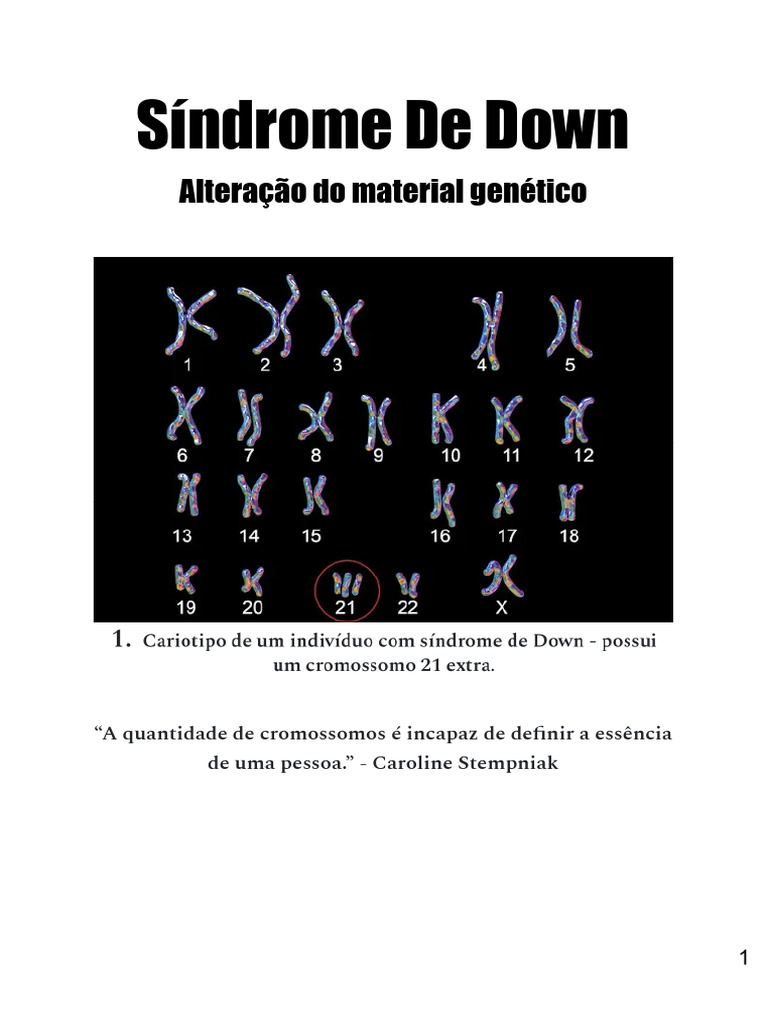 Síndrome de Down | PDF