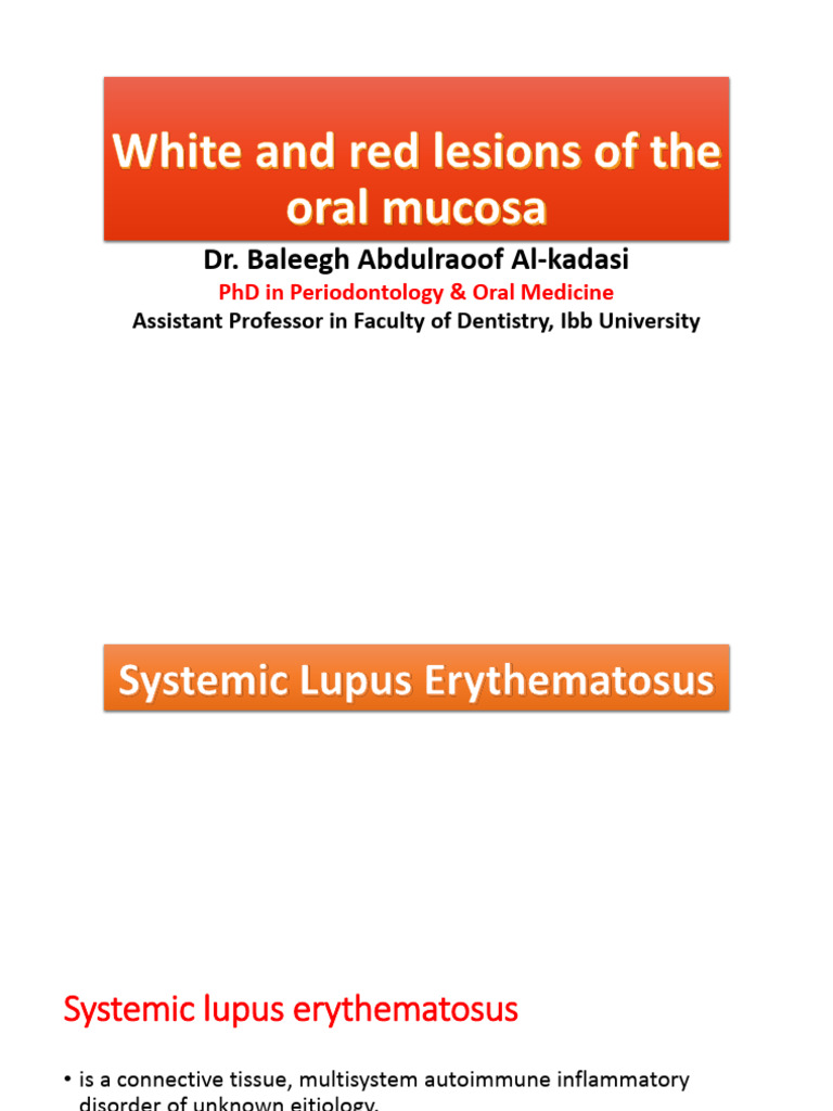 Systemic Lupus Erythematosus | PDF