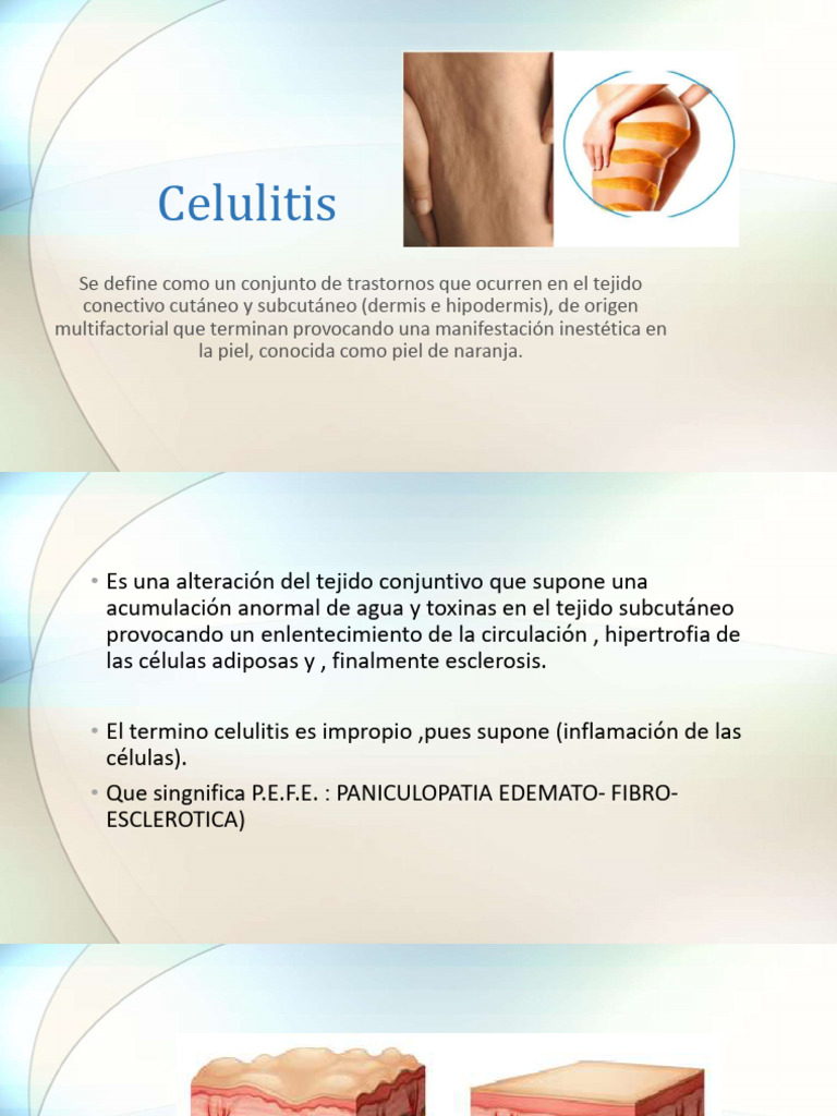 Celulitis | PDF