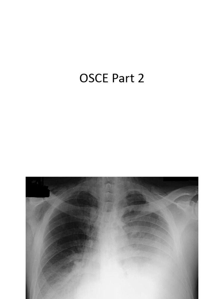 Osce | PDF