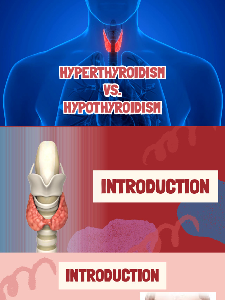 Hyperthyroidism vs. Hypothyroidism Guide | PDF | Thyroid | Self-Improvement