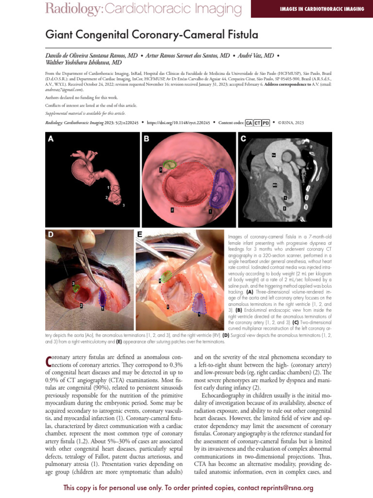 Ramos Et Al 2023 Giant Congenital Coronary Cameral Fistula | PDF