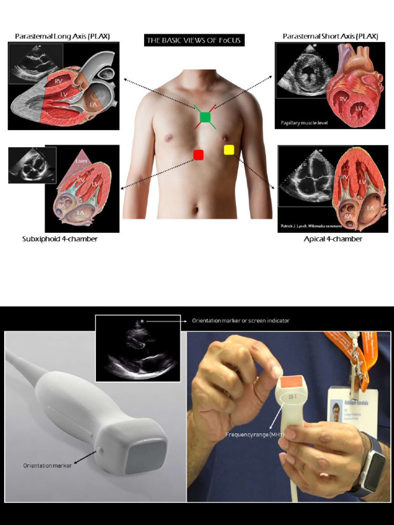 Echo Parasternal View | PDF