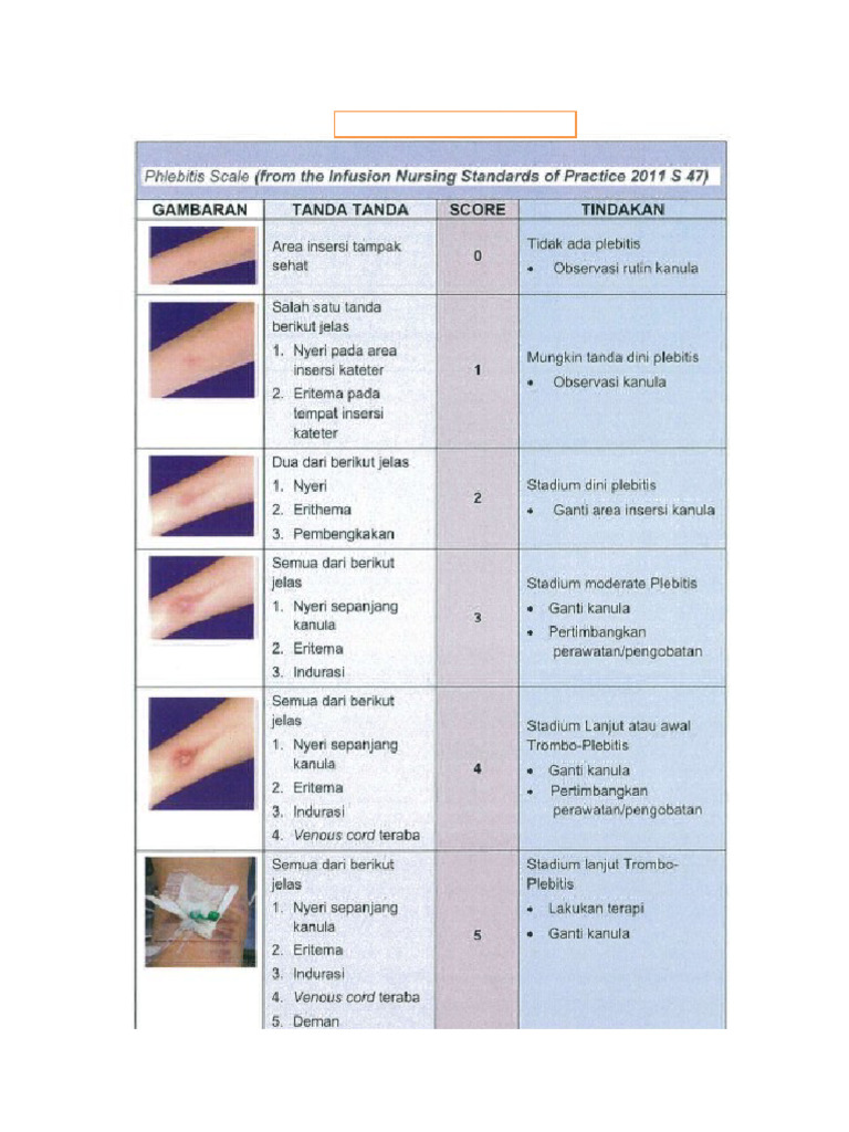 Score Plebitis | PDF