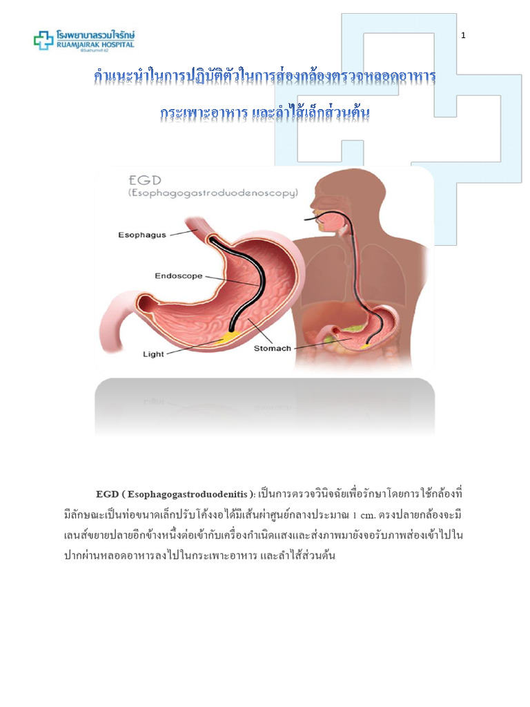 EGD (Esophagogastroduodenitis) | PDF