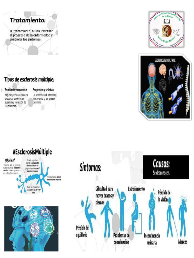 Esclerosis Multiple | PDF
