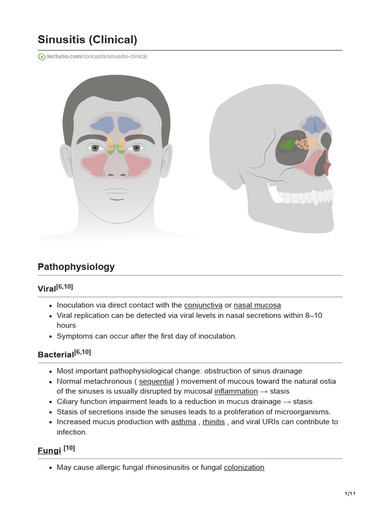 Sinusitis Clinical | PDF