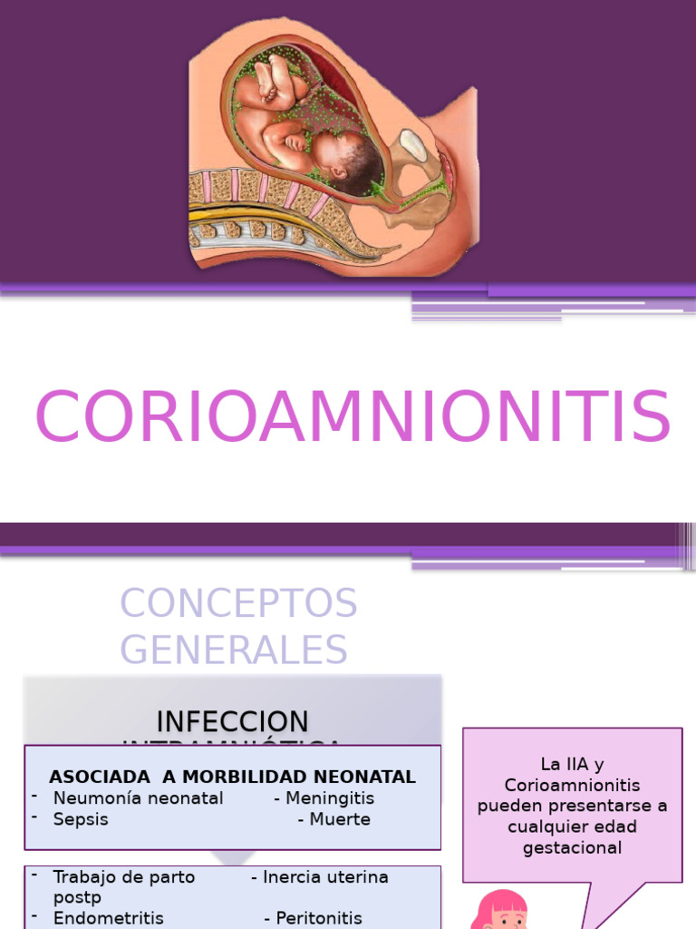 CORIAMNIONITIS | PDF