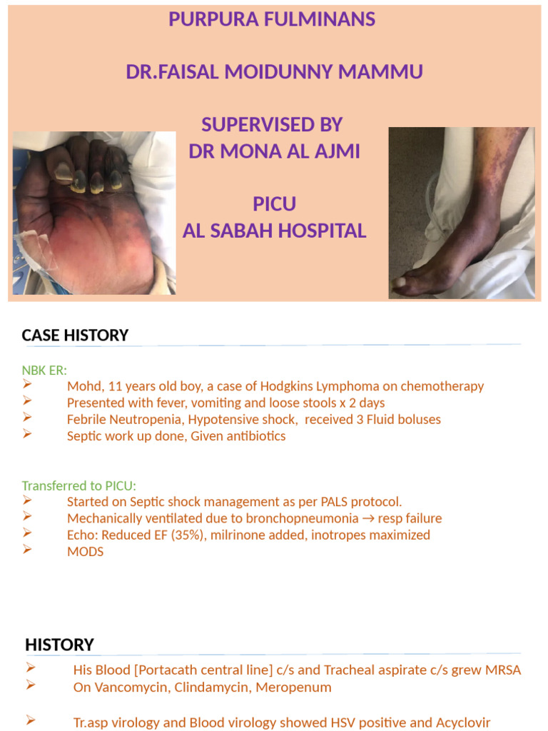 Purpura Fulminans | PDF