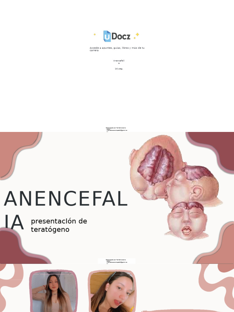 Anencefalia Presenta 482012 Downloadable 1209491 | PDF