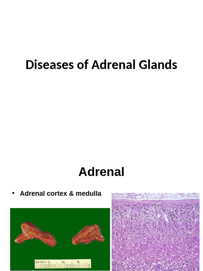 Endocrine Adrenal | PDF