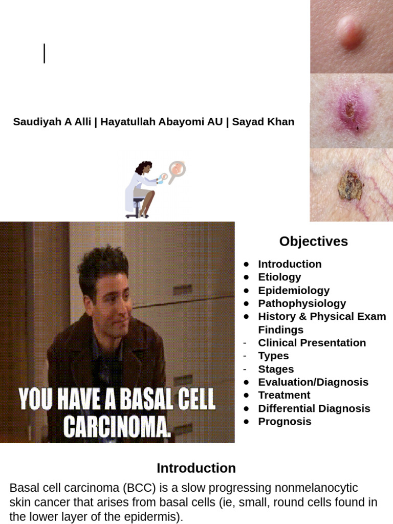 Basal Cell Carcinoma | PDF | Skin Cancer | Social Science