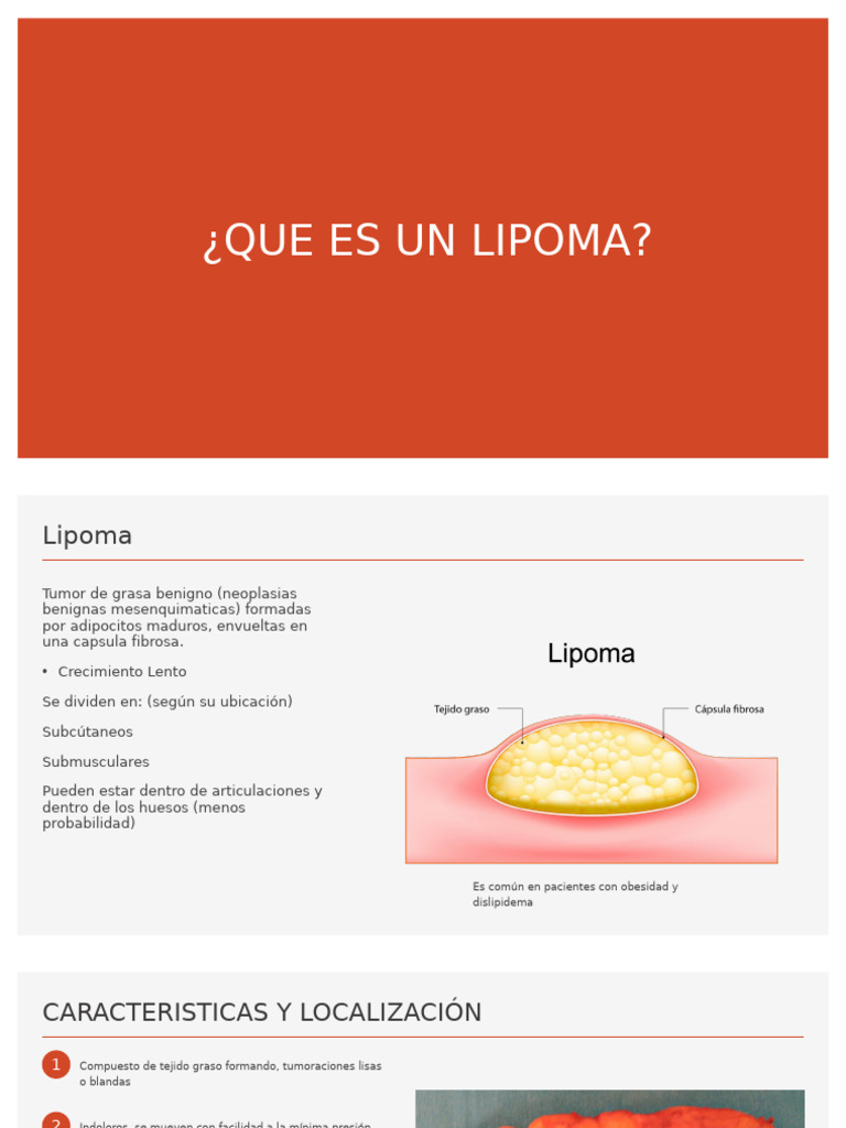 LIPOMA | PDF