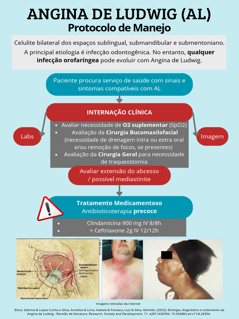 ANGINA DE LUDWIG - Pronto | PDF