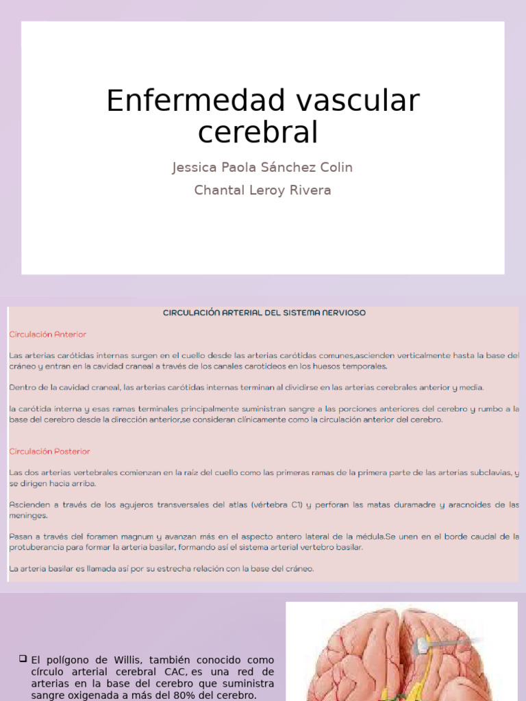 Exposicion Evc | PDF