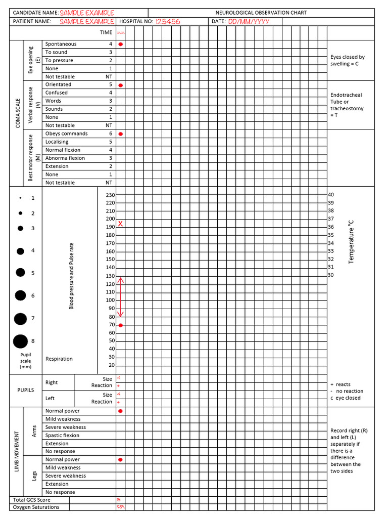 (EXAMPLE) Glasgow Coma Scale Neurological Observation Chart | PDF