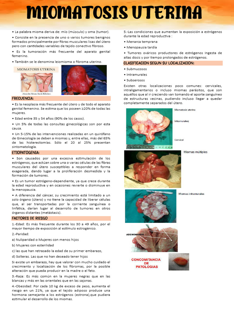 Miomatosis Uterina | PDF