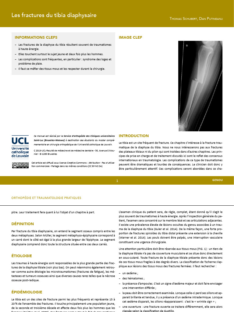 Thomas Schubert - Fracture Diaphyse Du Tibia | PDF